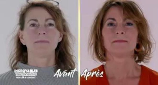 Incroyables Transformations Saison 1 | M6